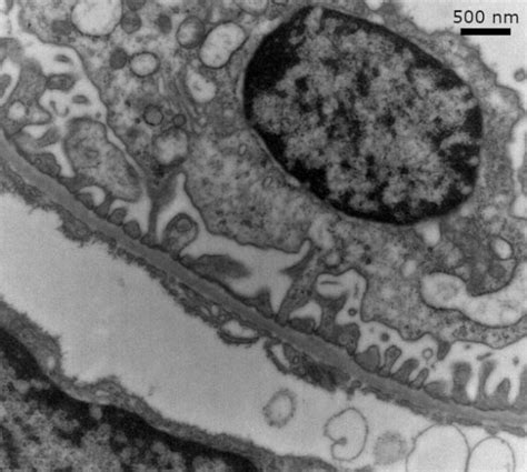 Comparing Afm With Tem And Sem