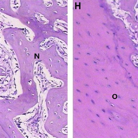 Contd G Histologic Evaluations Of The Mandibular Bone Defect Download Scientific Diagram