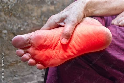 Tingling And Burning Sensation In Foot Of Asian Man Foot Pain Sensory