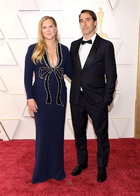 Amy Schumer Bronzed Her Uterus After It Was Surgically Removed Us Weekly