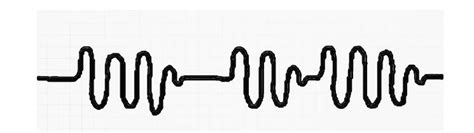 Biots Breathing Pattern An Overview 2025 Aandt Respiratory Lectures