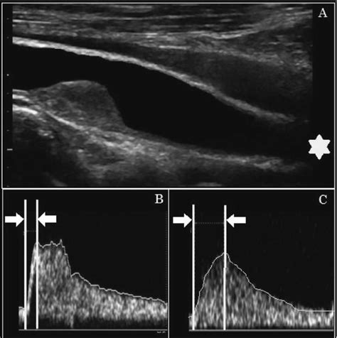 Measurement Methods Of Acceleration Time Act A The Linear Array