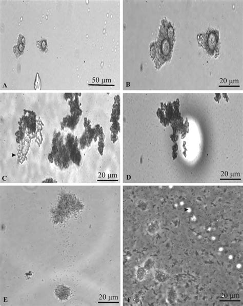 Microphotographs Of Marinobacter Aggregates Biofilms Over Crude Oil