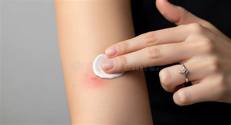 Bite Arm Stock Illustrations 1169 Bite Arm Stock Illustrations