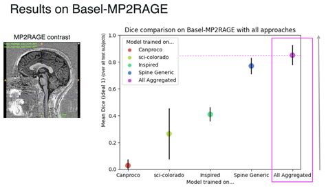 Spinal Cord Segmentation Generalizable Across Datasets