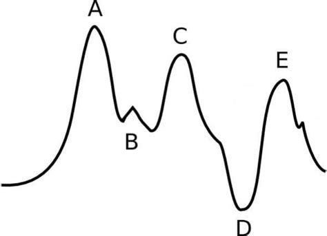 Intra Aortic Balloon Pump Waveform