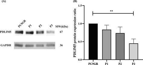Expression Of Pdlim5 In Pc9gr Cells A And B Western Blot Analysis Of