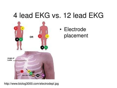 Ppt Ekg Powerpoint Presentation Free Download Id 4371250