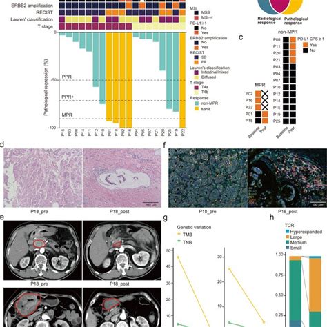 Immune Cell Deconvolution And Association With Responses To Neoadjuvant