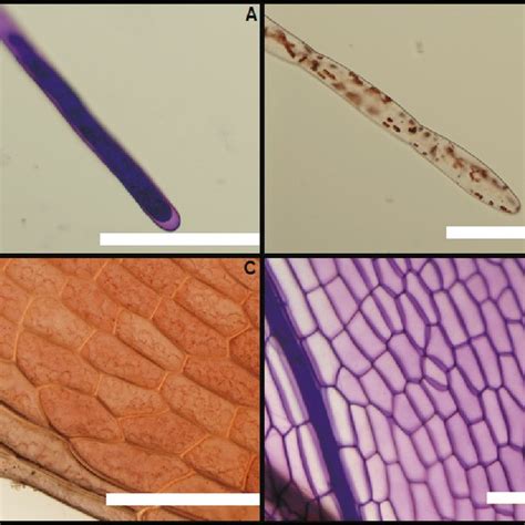 Light Microscopy Image Of A Young Protonemal Colony Of Physcomitrella Download Scientific