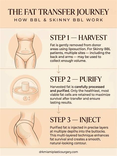 Bbl Vs Skinny Bbl Differences In Buttocks Augmentation