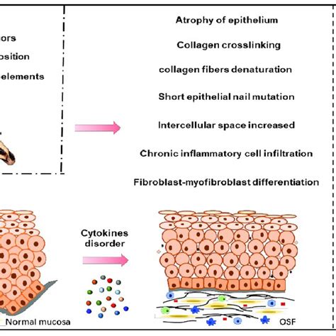 Treatment Methods And Principles Of Osf Download Scientific Diagram