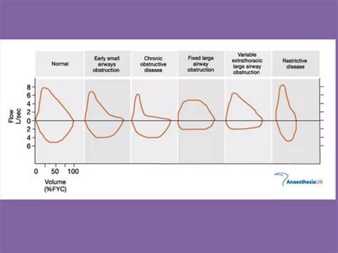Pulmonary Flow Volume Loops Dr Padmesh Pptx
