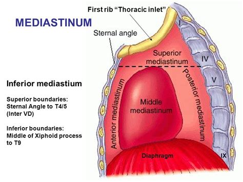 Xiphoidectomy Procedure