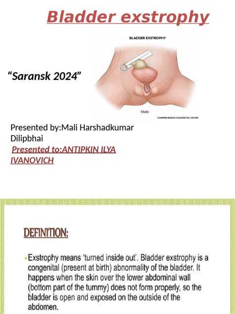 Bladder Exstrophy Pdf