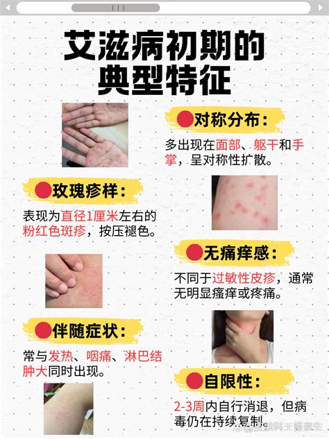 艾滋病初期皮疹特点？