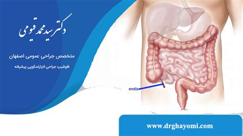 آپاندیس چیست؟ دکتر سیدمحمد قیومی