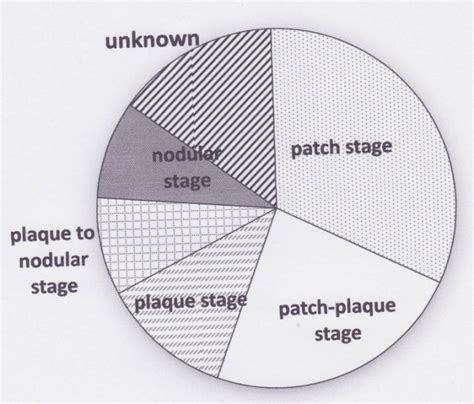 Pathological Stages Of Disease Discussion Classic Kaposis Sarcoma Is