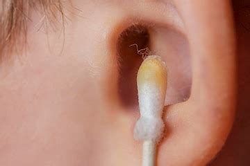 Premium Photo Cleaning The Ear With A Cotton Swab The Process Of