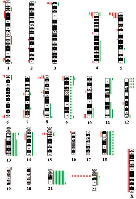 Ideogram Summarizing The Clinically Significant Cnvs In 109 Neonates