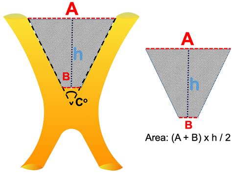 Graphic Representation Of The Prechiasmatic Space H The Distance From Download Scientific