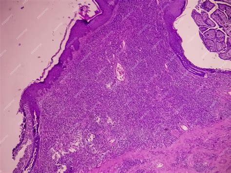 Premium Photo Histological Slide Under Microscopy Showing