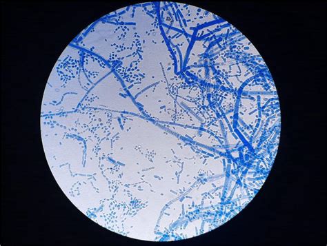 Pathogenic Mold Is Becoming A Global Health Priority