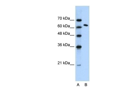 Supt16h Antibody Cat No 27 364 Prosci