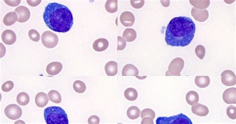 Medical Laboratory And Biomedical Science Circulating Reactive Plasma