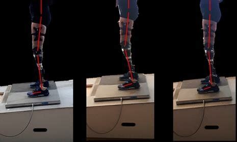 The Kinematic Strategies Of The Bilateral Trans Tibial Amputee