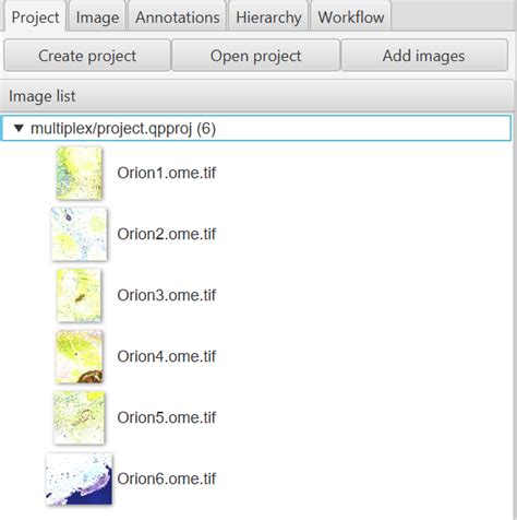 Creating A Brightfield Image Analysis Workflow — Image Scientist