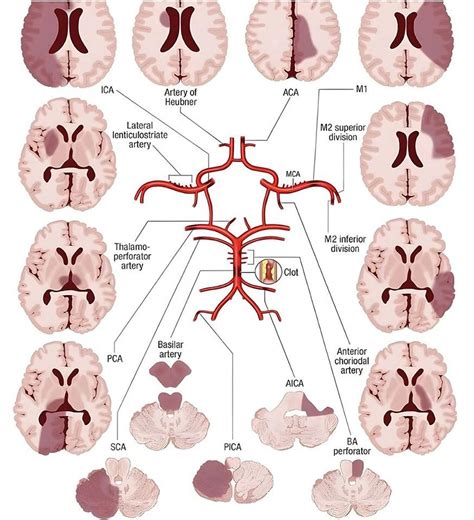 Kapil Jetha Posted On Linkedin