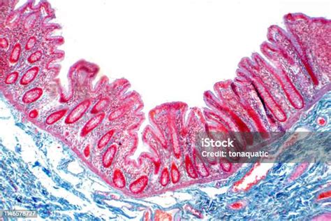 Menschlichen Dickdarm Gewebe Unter Mikroskop Ansicht Histologischen Für