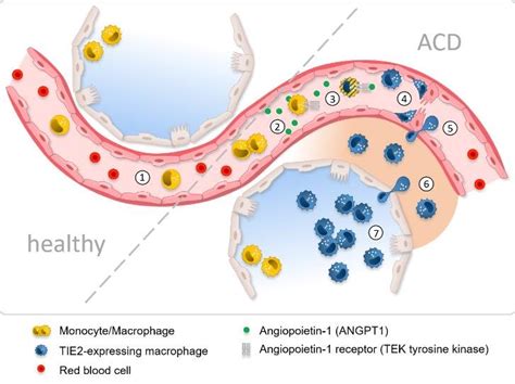 Intussusceptive Angiogenesis In Acd Download Scientific Diagram