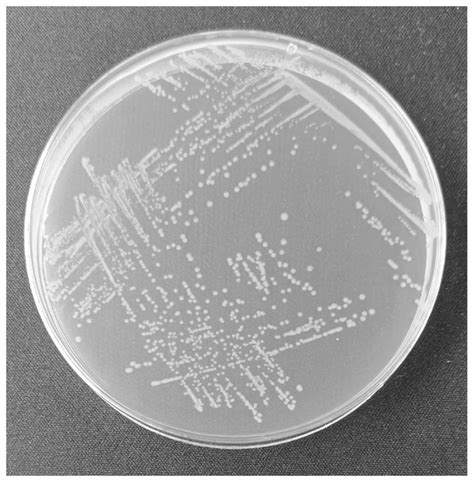 一种迪氏副拟杆菌及其应用的制作方法