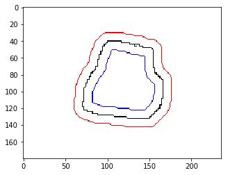 C How To Get An Expanded Or Contracted Contour In OpenCV Stack Overflow