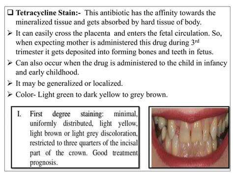 Diffrential Diagnosis Of Common Teeth Complaints Pptx