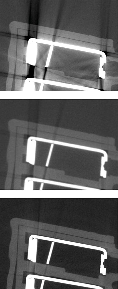 New Multi Spectral Computed Tomography