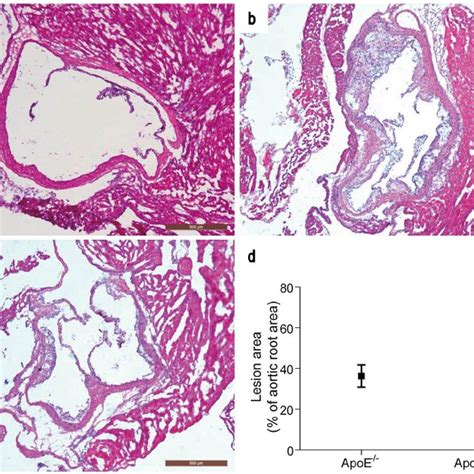 Nr1 Treatment Alleviated The Atherosclerotic Lesion Formation In The Download Scientific