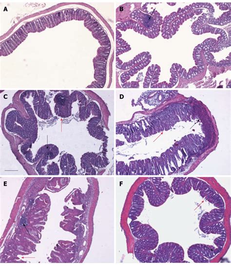 Differences In Histological Parameters During Experimental Colitis