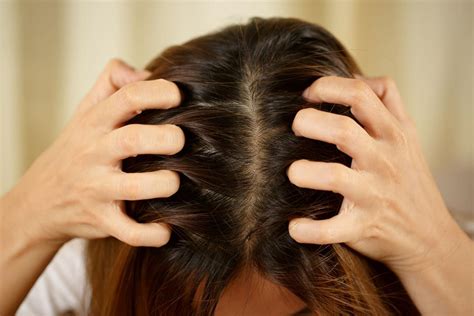 Did A Medication Trigger Patients Severe Scalp Rash