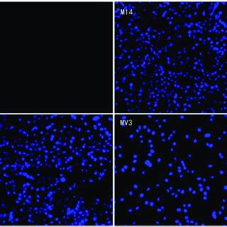 Comparison Of Invasion Ability Of 4 Types Of Cells Download Scientific Diagram