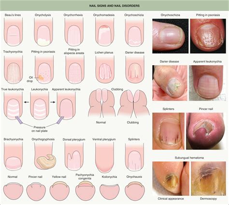 Nail Disorders Clinical Tree