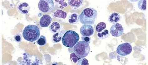 Rapi Diff Ii Stain Kit Extra Iqmstore