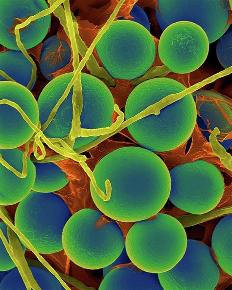 Aspergillus Nidulans Hyphae And Sexual Spores 1 Greeting Card By