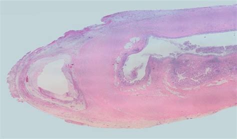 Histologic Image Of False Diverticulum Located At The Tip Of The Download Scientific Diagram