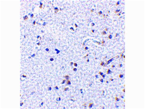 Tslp Antibody 600 401 Fr6 Rockland