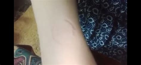 Girl Biting Video Thisvid Com