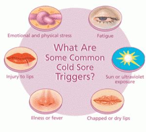 Cold Sore Stages Identification And Treatment Artofit
