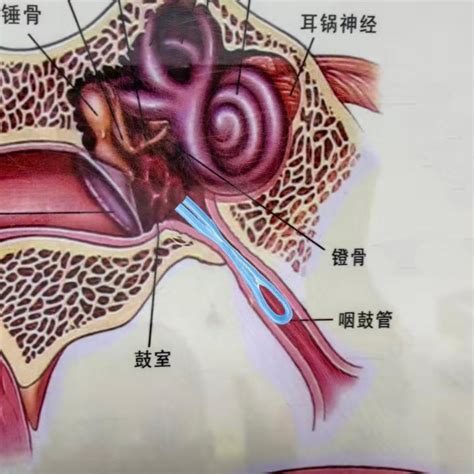 咽鼓管置管术怎么选？小林管vs张氏管，一篇看懂核心差异 知乎